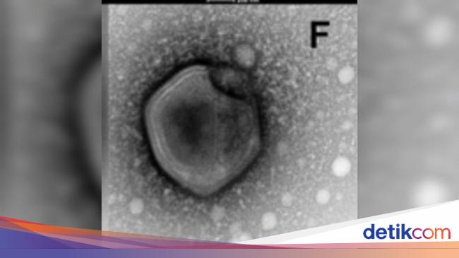 Ada Virus Zombie yang Dihidupkan Kembali Setelah 50.000 Tahun, Apakah ...