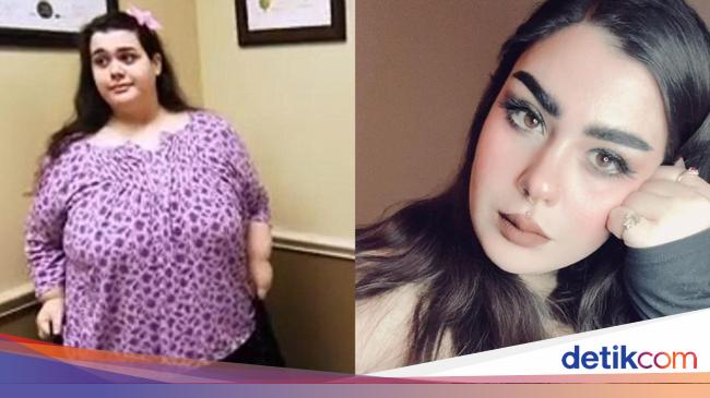 Potret Transformasi Wanita yang Dulunya Berbobot 317 Kg, Kini Bikin Pangling!