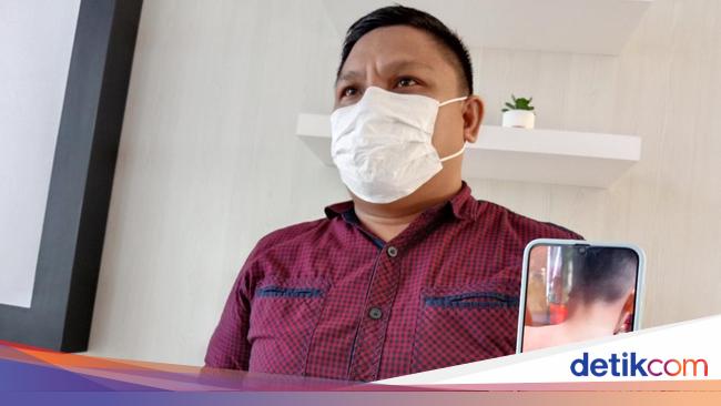 Siswa SD di Manado Diduga Dianiaya Gurunya Sampai Lebam Masih Trauma Siswa SD di Manado Diduga Dianiaya Gurunya Sampai Lebam Masih Trauma