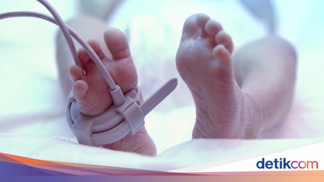 Viral Bayi Lahir dengan Mata Unik Disebut Mirip Alien, Inikah Penyebabnya?