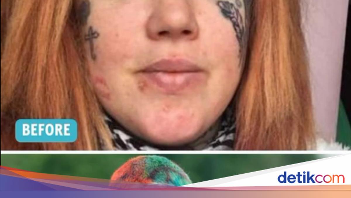 Kisah Wanita Inggris Punya 800 Tato di Sekujur Tubuh, Kini Dikucilkan