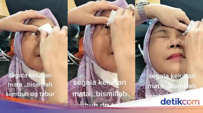 Viral Bubuk Ditabur di Mata Diklaim Obati Katarak, Dokter Ungkap Risiko Kebutaan