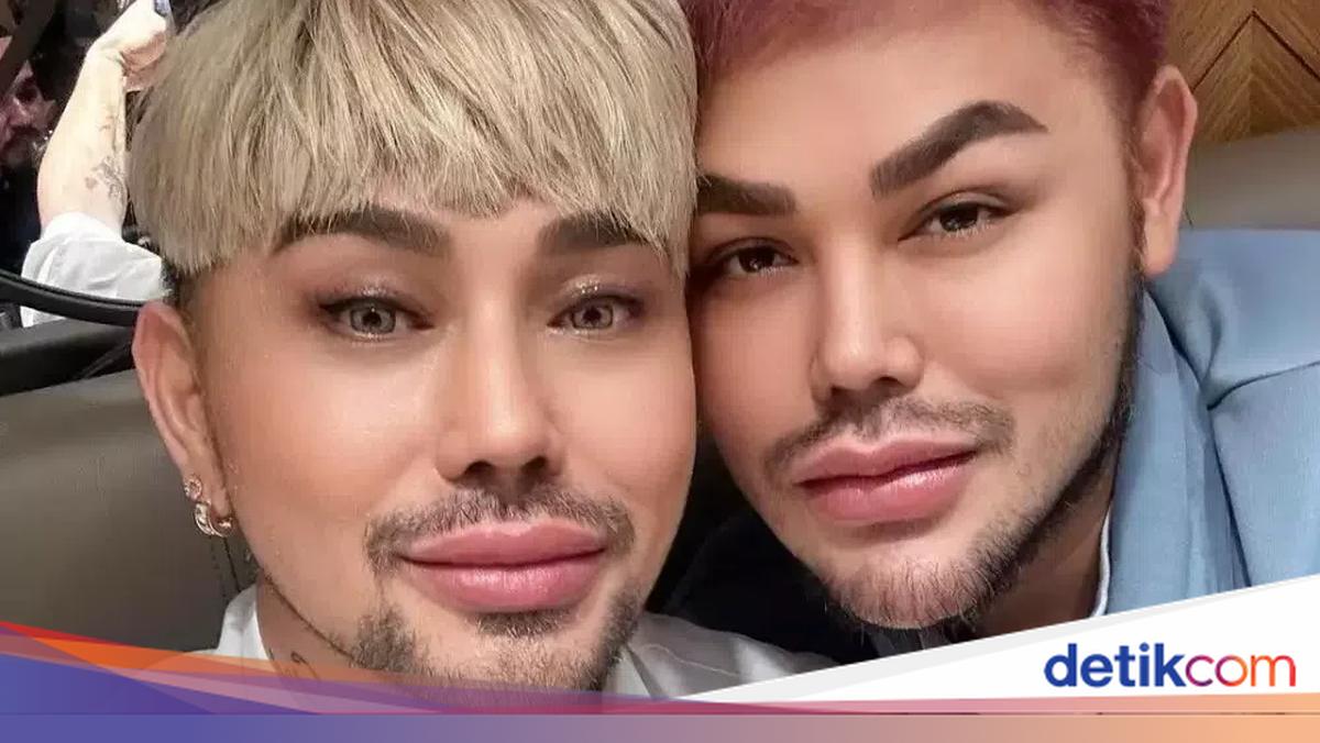 8 Potret Ivan Gunawan & Caren Delano Disebut Mirip Setelah Operasi Plastik