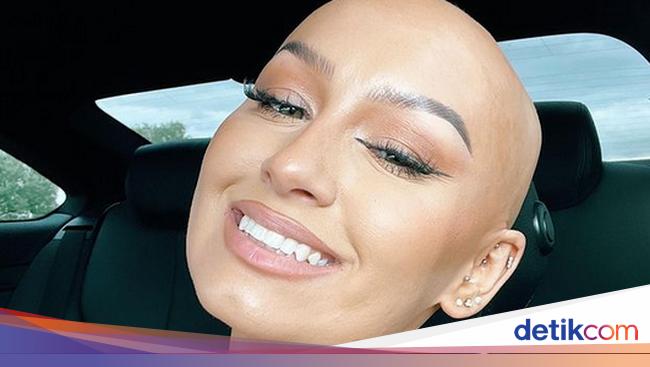8 Potret Beauty Influencer Berkepala Botak Ingin Dobrak Standar Kecantikan
