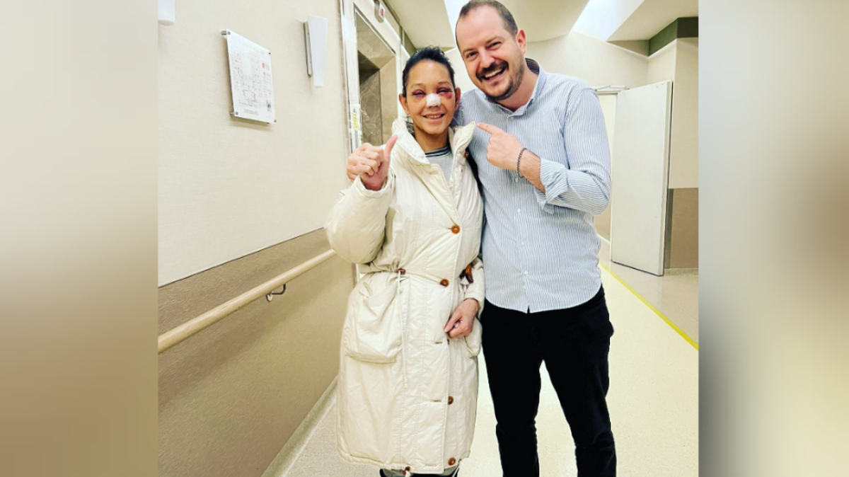 Muncul dengan Wajah dan Mata Lebam, Bunda Corla Operasi Plastik?