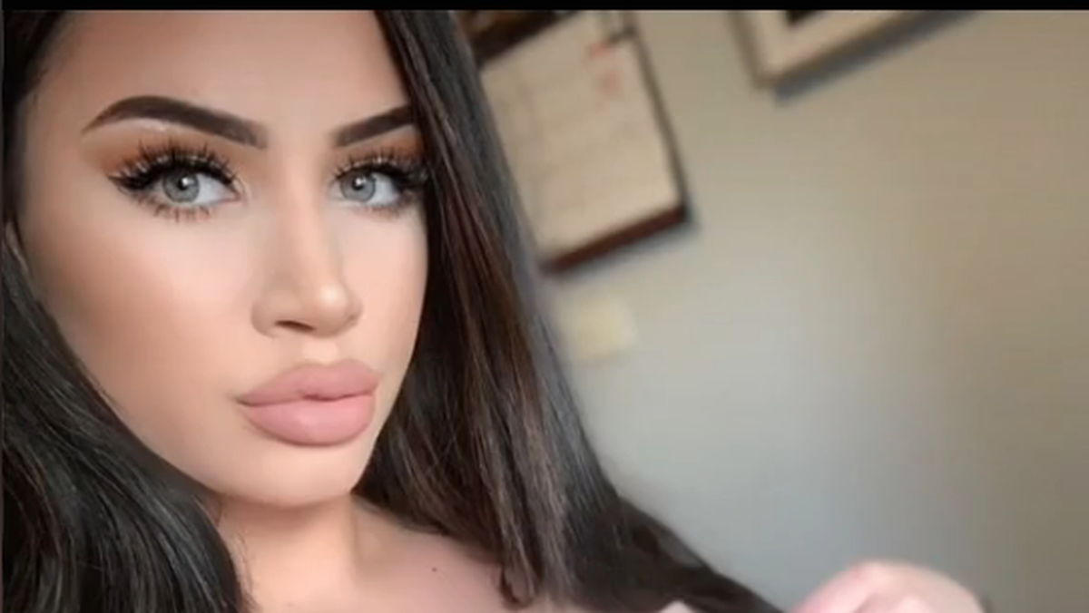 Wanita Idap Gigantomastia, Payudara Tak Berhenti Tumbuh Berakhir ...