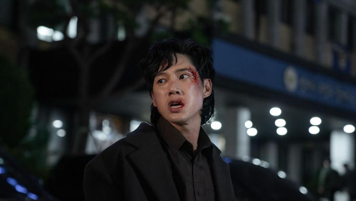 Dialami Jeon Jae Joon di The Glory, Apa Itu Penyakit Glaukoma?