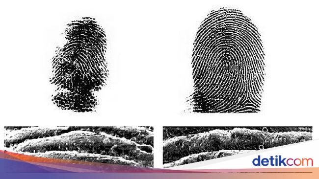 Kenapa Sidik Jari Orang Berbeda-beda? Ada Hubungannya dengan Garis Zebra