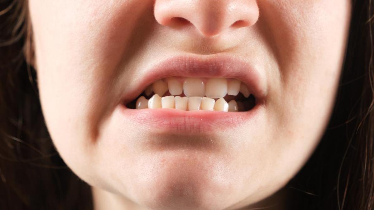 Viral Istilah Mewing di Medsos, Termasuk Operasi Plastik? Ini Penjelasannya