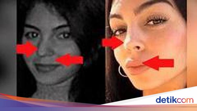 Mantan Pacar Ronaldo Serang Georgina Rodriguez, Ungkap 'Bukti' Pernah Oplas