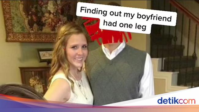 Viral Kisah Wanita Baru Sadar Pacarnya Punya 1 Kaki Setelah 3 Bulan Pacaran
