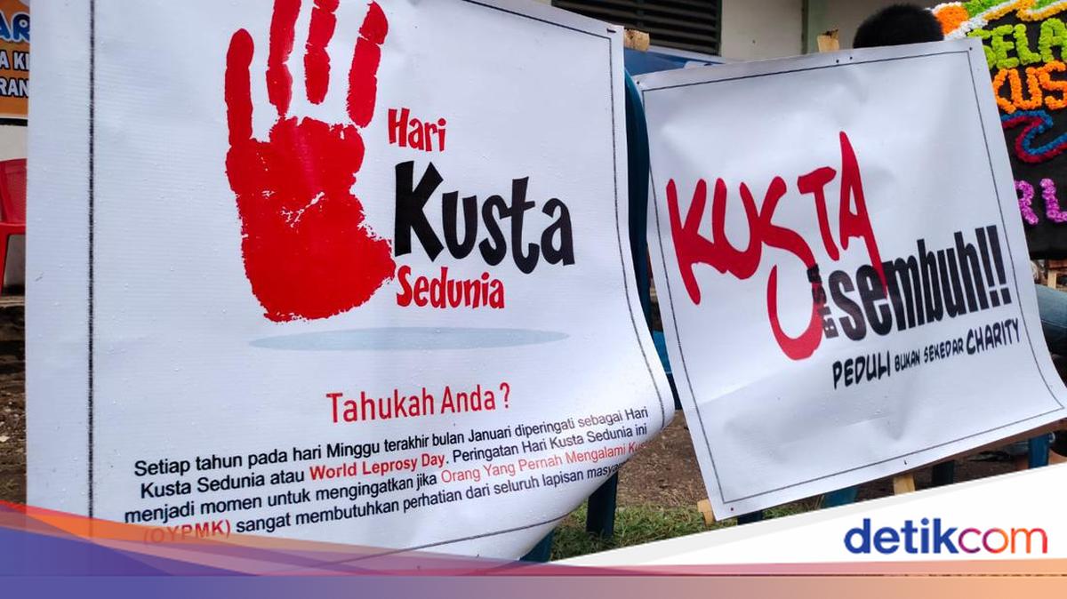 Hari Kusta Sedunia 28 Januari, Pelajari Sejarahnya di Sini