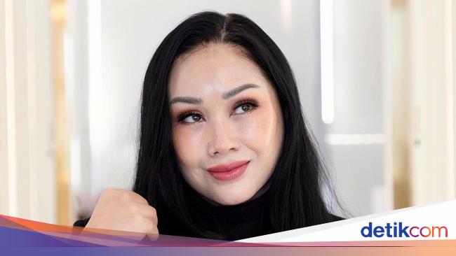 Curhat Titi DJ Ceritakan Rasanya Oplas Anti Aging, Cuma Memar Dikit