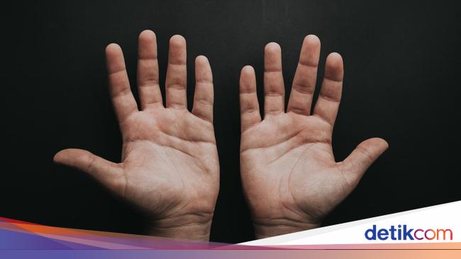 Cara Menyembuhkan Kutu Air di Tangan dengan Bahan Alami