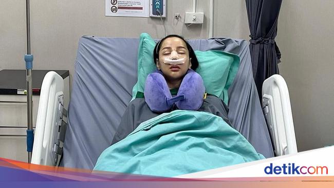 6 Foto Before-After Wajah Baru Lucinta Luna Pasca Oplas Hidung Lagi