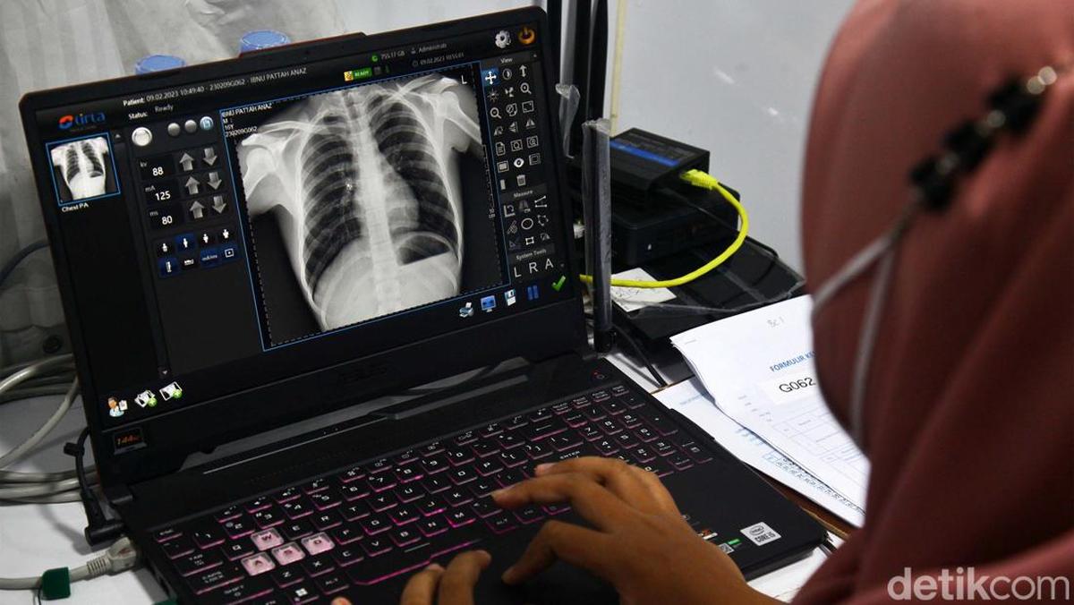 Apa Itu Tes Skrining? Penting Untuk Mendeteksi Kondisi Kesehatan Kamu!