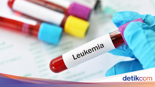 Gejala Leukemia, Jenis, dan Pencegahan untuk Menekan Risiko