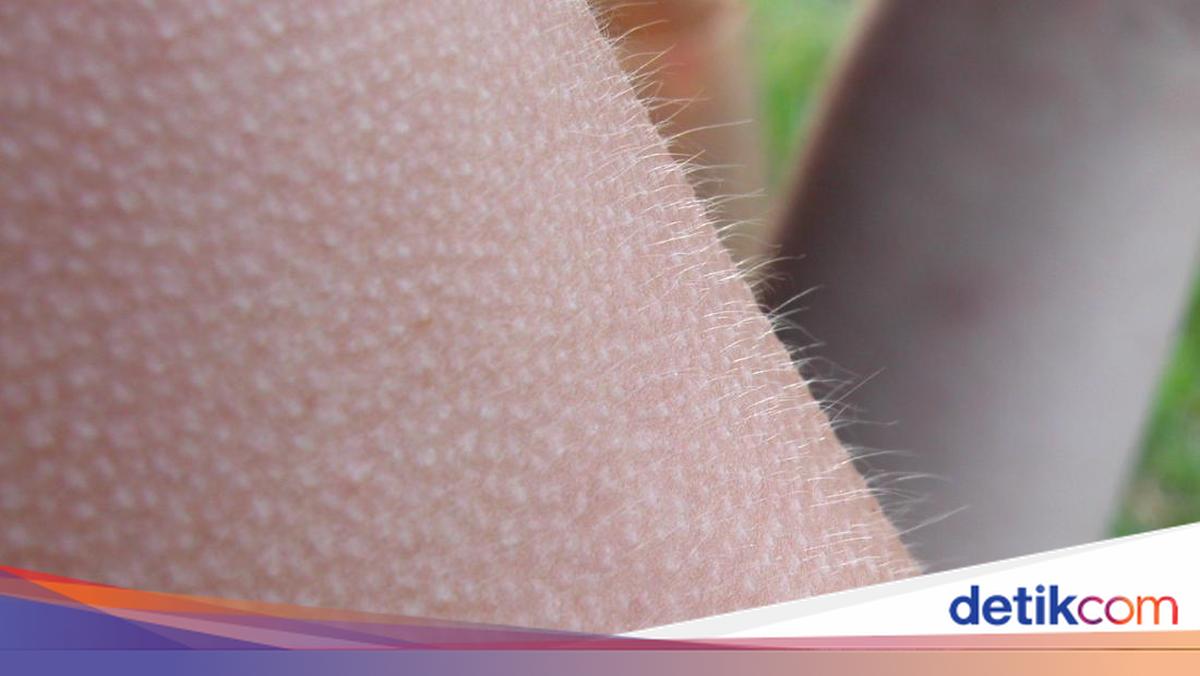 Terungkap! Ternyata Ini Alasan Manusia Bisa Merinding Menurut Ahli Biologi