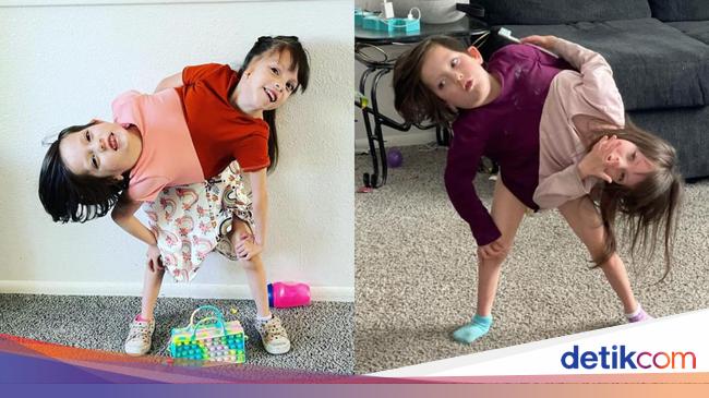 Bikin Haru! Viral Ibu Besarkan Kembar Siam, Sempat Diduga Tak Akan ...