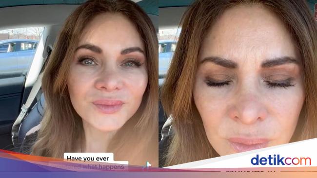 Viral Wanita Berhenti Suntik Botox Setelah 20 Tahun, Penampakan ...