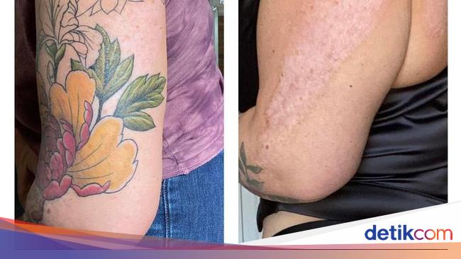 Potret Seni Tato Tutupi Bekas Luka Menjadi Artistik