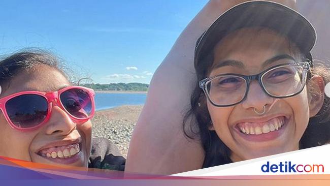 Kisah Kembar Siam Berbagi Kelamin, Hanya Satu yang Sudah Punya Pacar