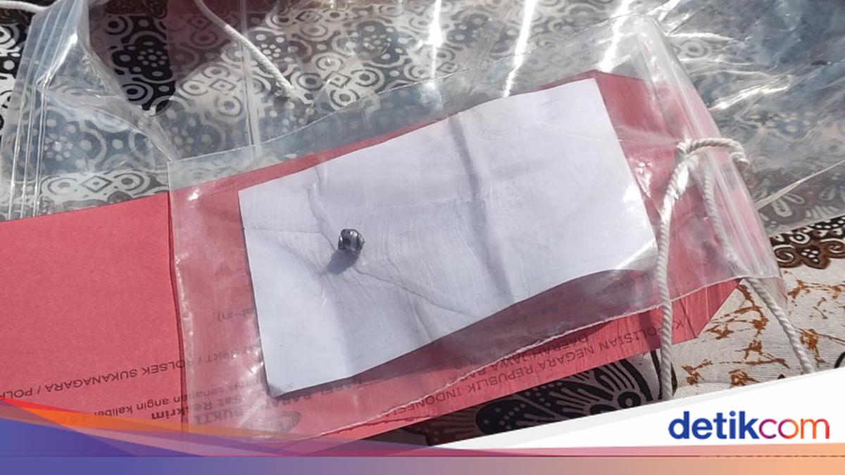Ngeri! Ini Wujud Proyektil yang Bersarang di Kepala Ria Puspita