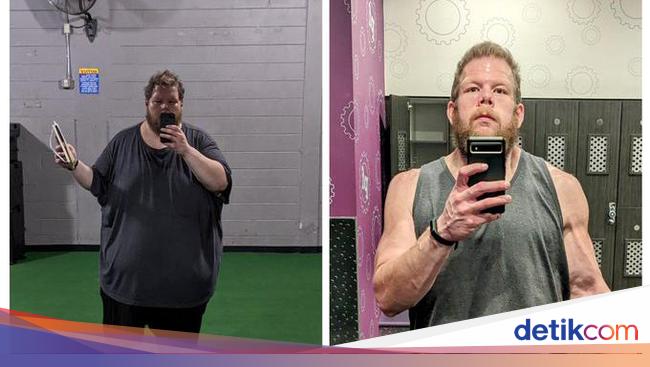 Potret Pria Pangkas BB hingga 152 Kg! Before-Afternya Bikin Merinding
