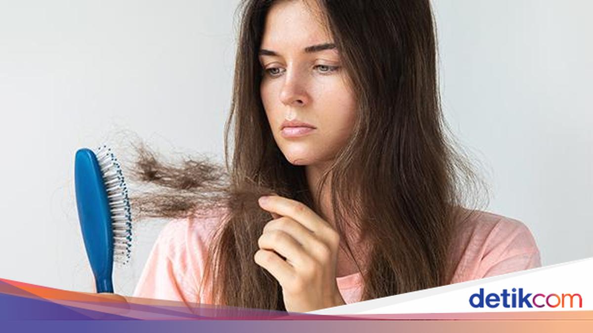 Matcha Latte Disebut Bisa Bikin Rambut Rontok, Dokter Beri Penjelasan