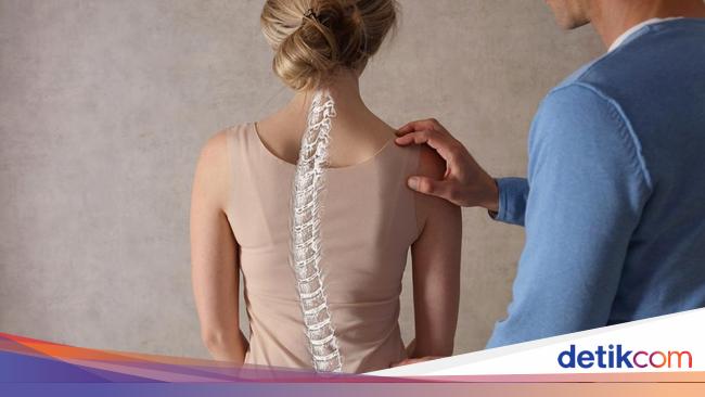 Penjelasan Lengkap Skoliosis, Lordosis, dan Kifosis yang Wajib Diketahui! Penjelasan Lengkap Skoliosis, Lordosis, dan Kifosis yang Wajib Diketahui!