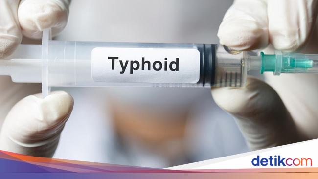 12 Gejala Tipes pada Anak yang Wajib Diketahui Orang Tua!