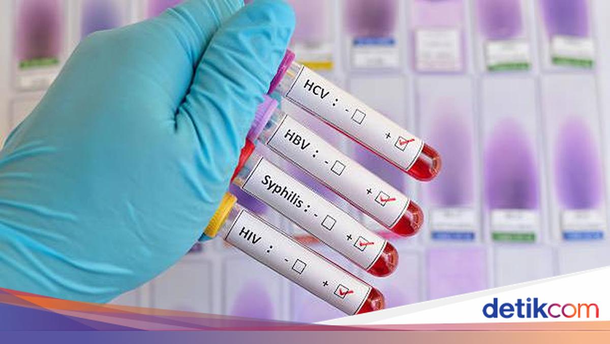 Horor 1.214 Kasus HIV/AIDS di Sulsel Didominasi Seks Sesama Pria