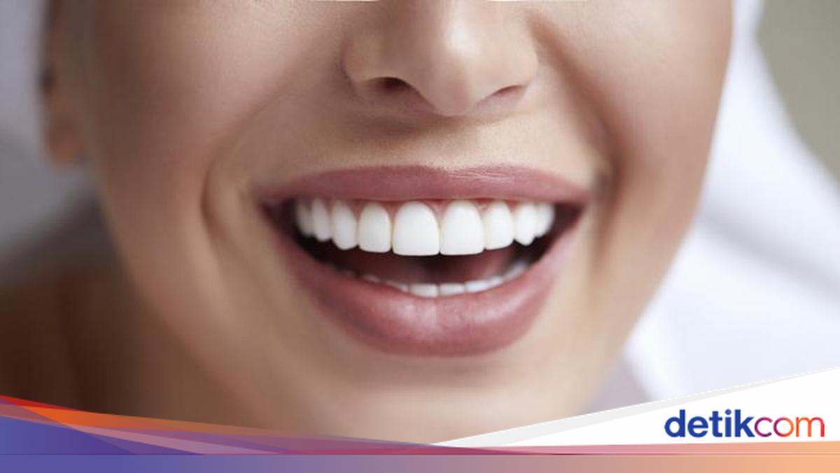 Agar Gigi Kuat dan Sehat Jangan Sering Konsumsi 5 Makanan Ini