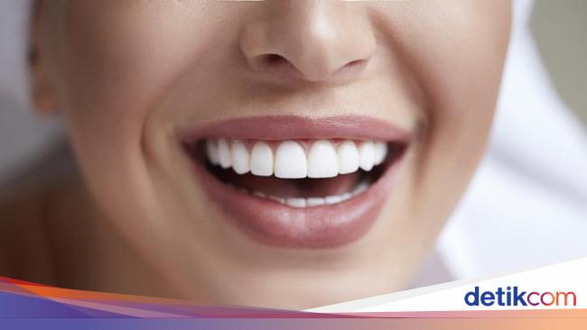 Agar Gigi Kuat dan Sehat Jangan Sering Konsumsi 5 Makanan Ini