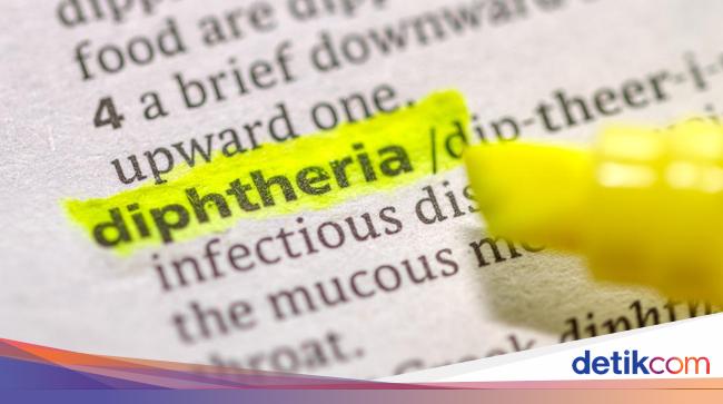 Difteri: Pengertian, Gejala, dan Cara Mencegahnya