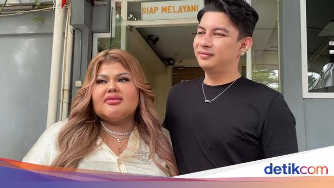 Shindy Samuel Turun 34 Kg Usai Operasi Pengecilan Lambung
