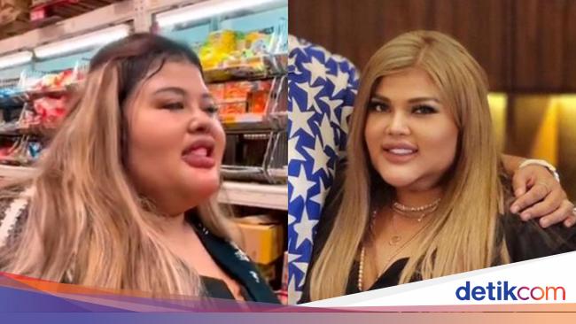 Kulineran Shindy Samuel, Selebgram yang Turun BB 34 Kg Usai Operasi ...