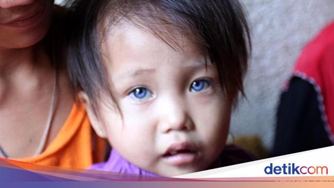 Pesona Bola Mata Tiga Warna Amelia Anggraeni dari Bandung