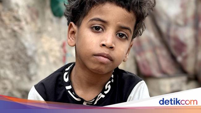 Penderitaan Anak-anak Yaman Jadi Korban Perang Bertahun-tahun