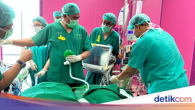 Bayi Kembar Siam Asal Pasuruan Berhasil Dipisahkan di RSSA Malang