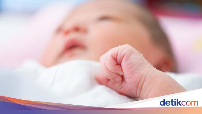 Mengenal Fenomena Bayi 'Mengandung' Janin