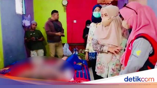 Derita Gadis Belia Di Tegal Idap Penyakit Ssss Sekujur Tubuh Melepuh