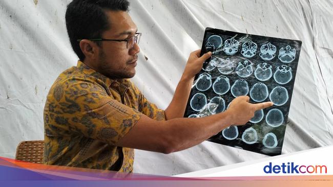 Polisi Selidiki Kasus Siswa SMA di Aceh Dikeroyok Abang Kelas