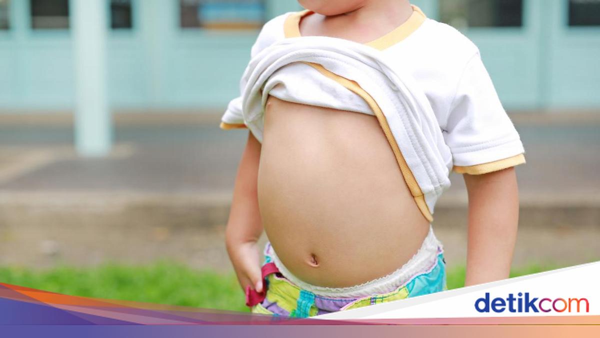 14 Gejala Cacingan pada Anak Beserta Cara Mengatasinya