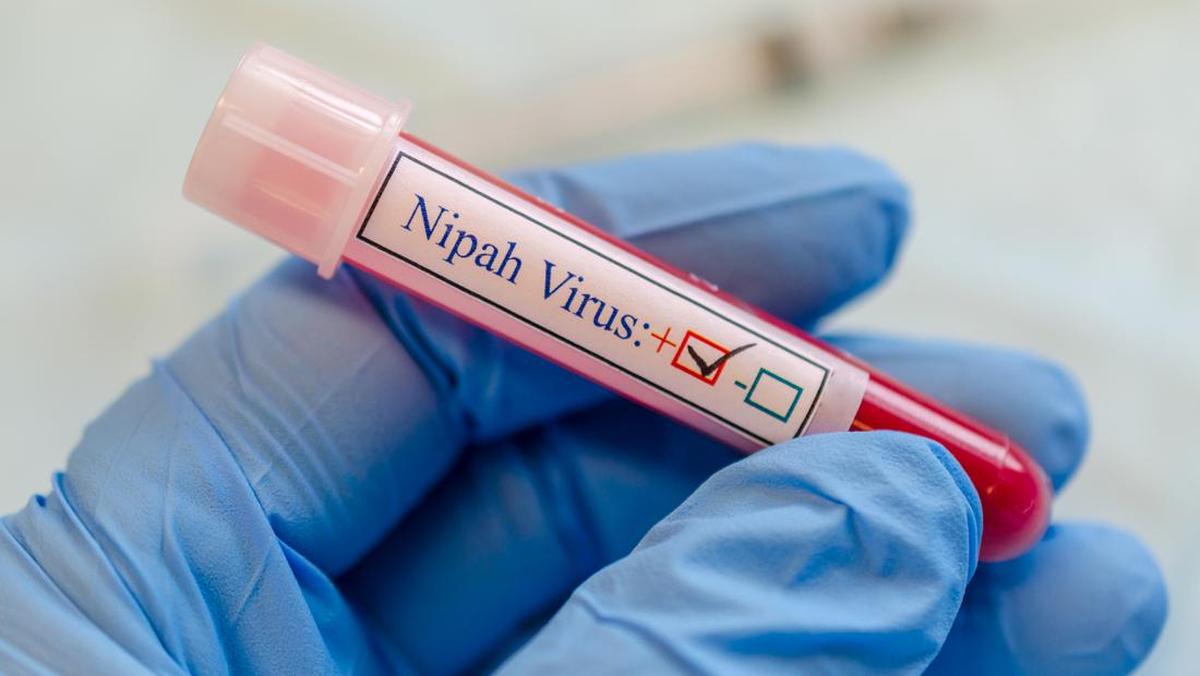 Dugaan Sumber Penularan Virus Nipah di India, Picu Perawat Tertular ...