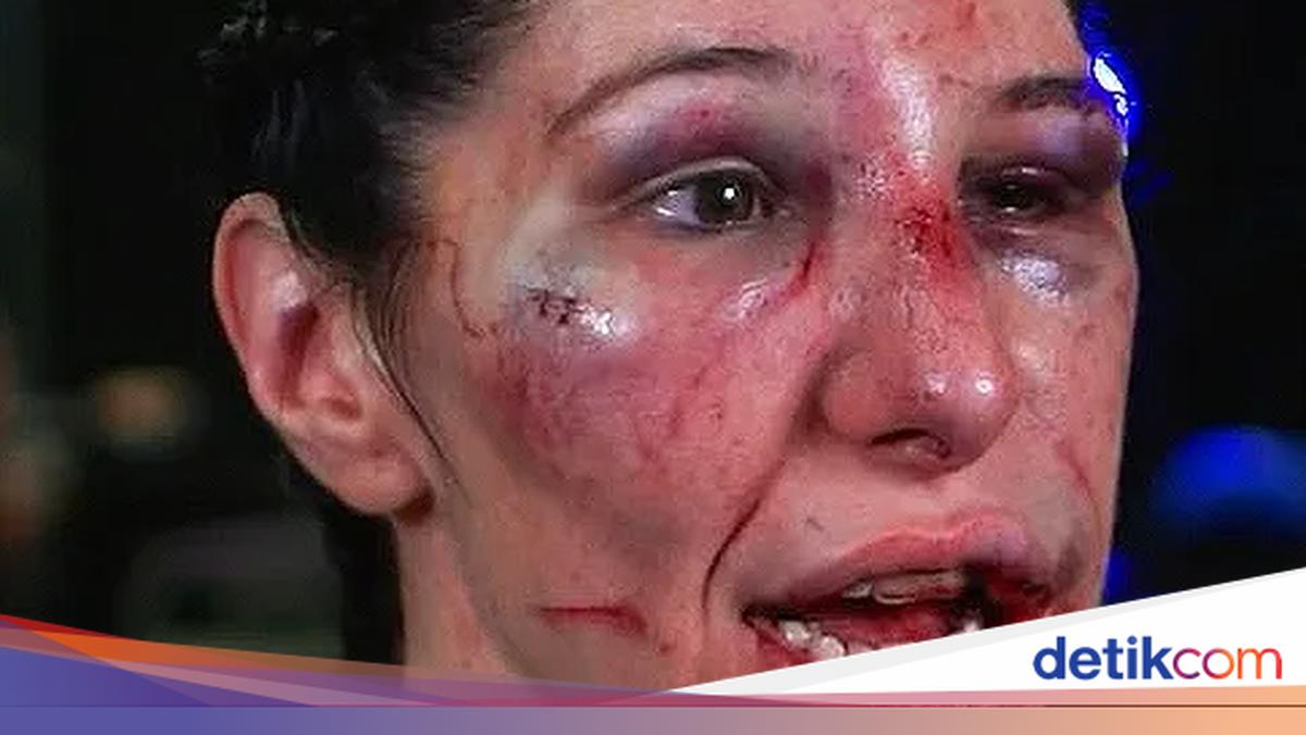 Viral Petarung Muslimah Pertama Babak Belur Pascatanding Sampai Tak Dikenali