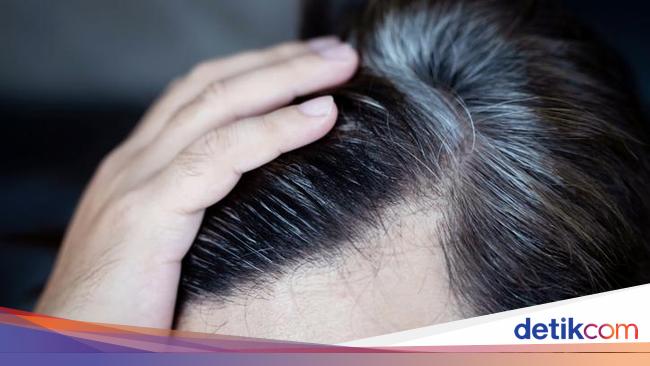 Penyebab Rambut Beruban dan Cara Memperlambatnya