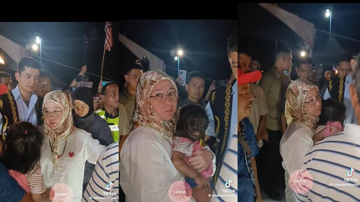 Bocah Malaysia Idap 'Sindrom Manusia Serigala', Wajah Penuh Bulu Sejak ...