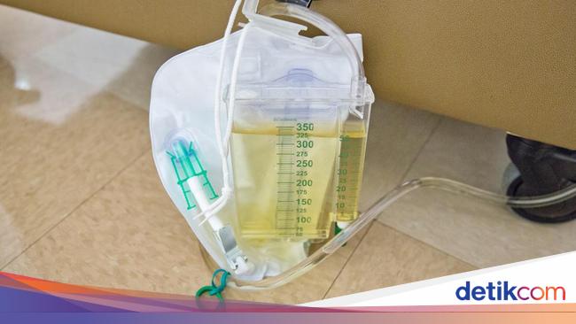 Apa Itu Kateter Urine? Ketahui Jenis dan Kondisi Medis Yang Memerlukannya