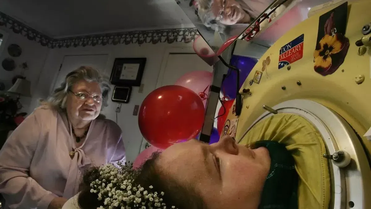 Hidup 60 Tahun di Paru-paru Besi karena Polio, Meninggal karena Mati ...